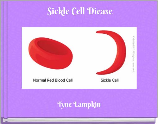 "Sickle Cell Diease" - Free stories online. Create books for kids ...